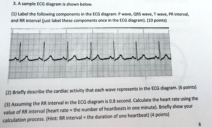 SOLVED: 3. A sample ECG diagram is shown below: (1) Label the following ...