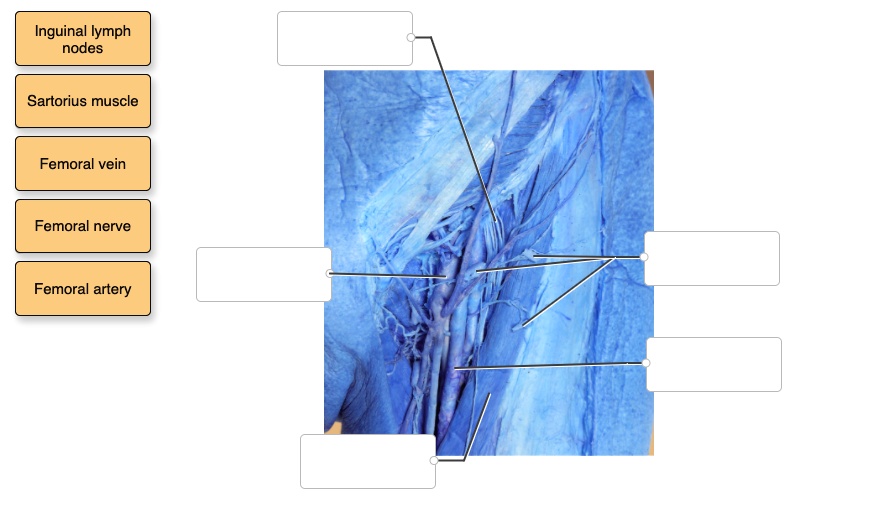 Inguinal lymph nodes Sartorius muscle Femoral vein Femoral nerve ...