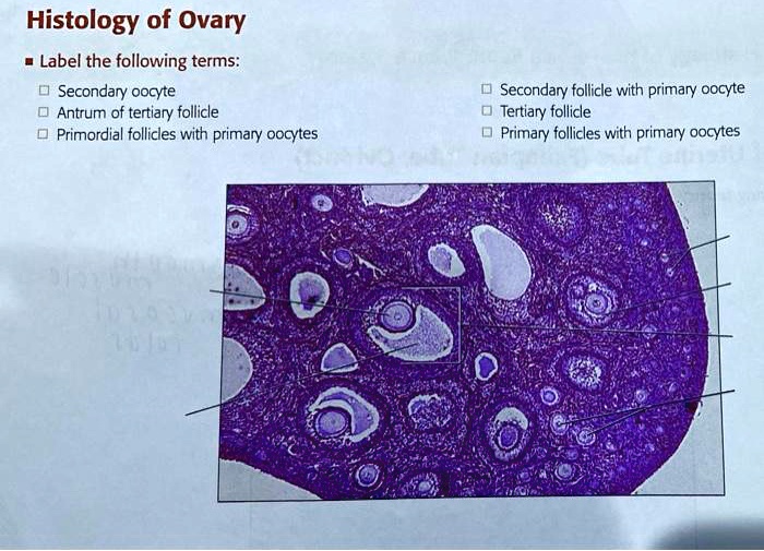 Histology of Ovary =Label the following terms: Secondary oocyte Antrum ...