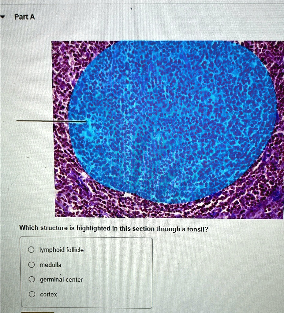 Part A Which structure is highlighted in this section through a tonsil? lymphoid follicle ...