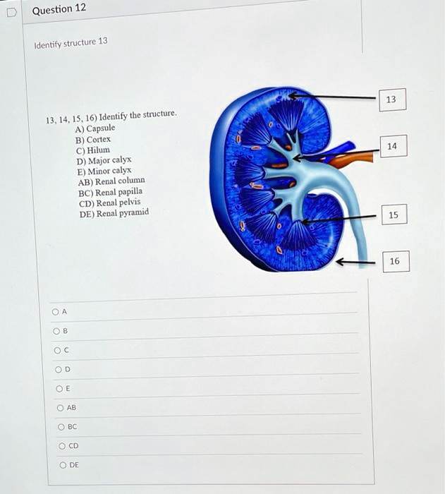 question 12 identify structure 13 13 13141516identify the structure ... question 12 identify structure 13 13 13141516identify the structure ...