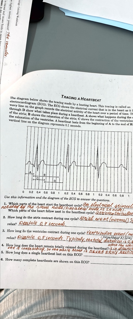 TRACING A HEARTBEAT The diagram below shows the tracing made by a ...