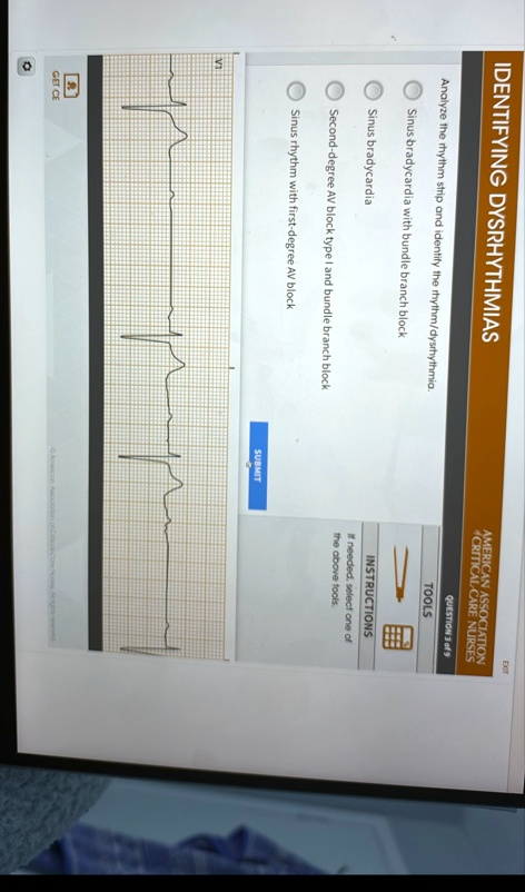 identifying dysrhythmias analyze the rhythm strip and identify the ...