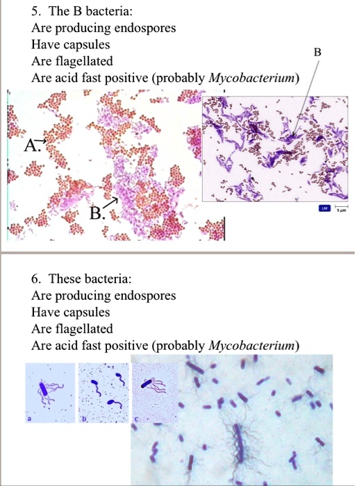 SOLVED: The B bacteria: Are producing endospores Have capsules Are ...