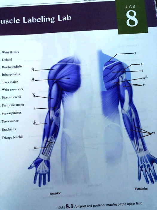 SOLVED: Lab 8 Muscle Labeling Lab Wrist flexors Deltoid Brachioradialis ... SOLVED: Lab 8 Muscle Labeling Lab Wrist flexors Deltoid Brachioradialis ...