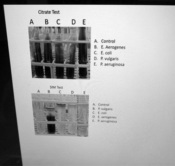 SOLVED: Citrate Test A B C D E Control E. Aerogenes E. coli P. vulgaris ...