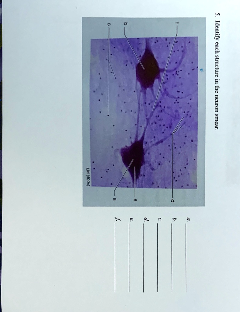 SOLVED: I need to identify each structure in the neuron smear. Here's ...