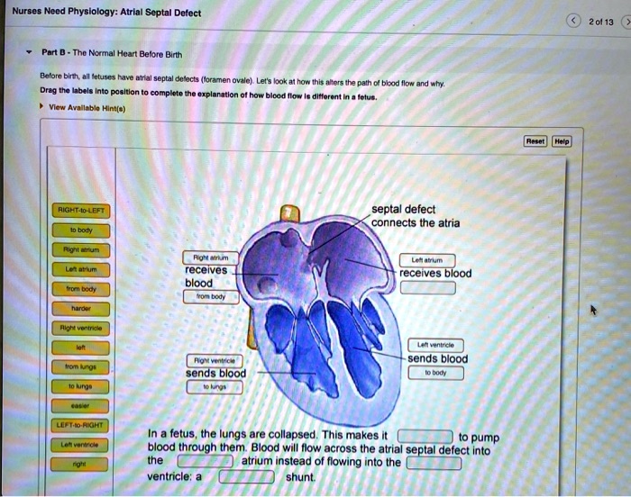 Nurses Need Physiology: Atrial Septal Defect ? Part B - The Normal ...