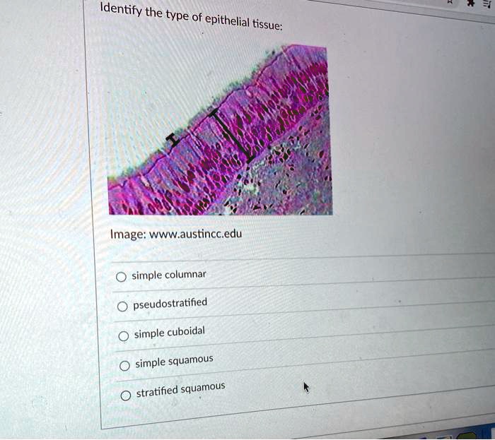 SOLVED: Identify the type of = epithelial = tissue: Image: wwwaustincc ...