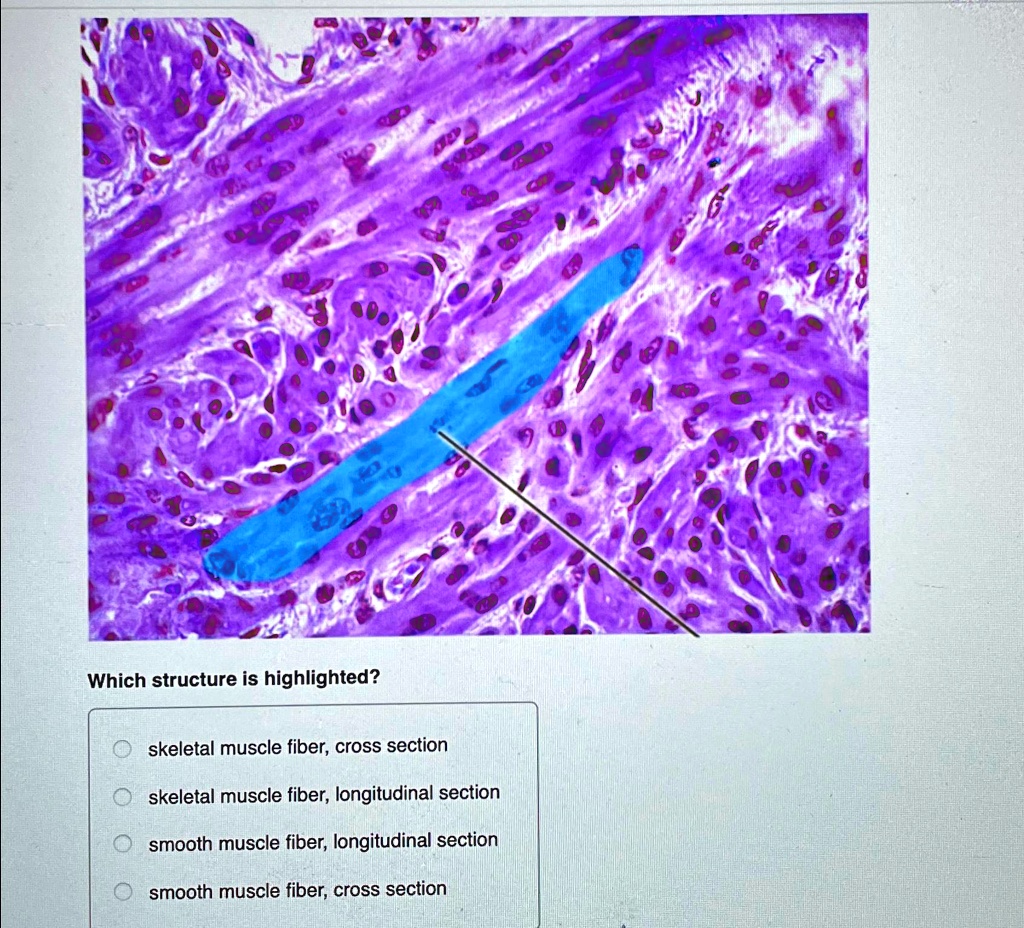 Which structure is highlighted? skeletal muscle fiber, cross section ...
