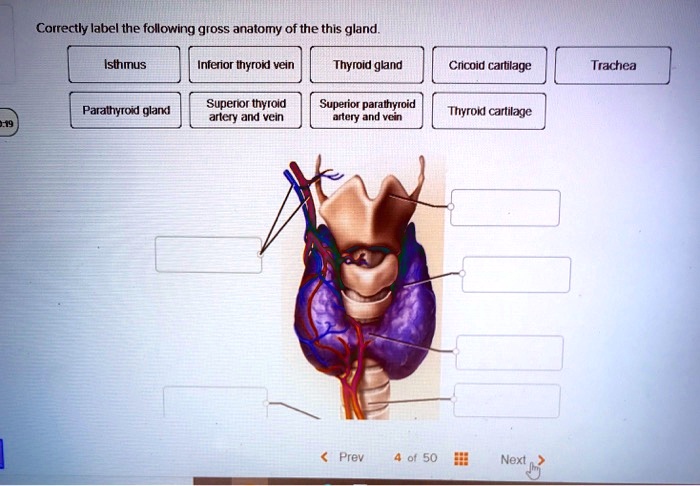 SOLVED: Correctly label the following gross anatomy of the gland. Correctly label the following ...