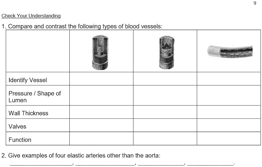 check your understanding compare and contrast the following types of ...