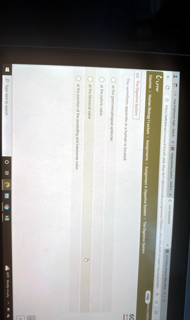 The vermiform appendix in a human is located: at the gastroesophageal ...