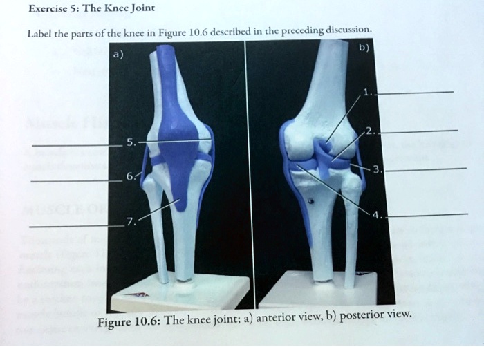 Exercise 5: The Knee Joint Label the parts of the knee in...
