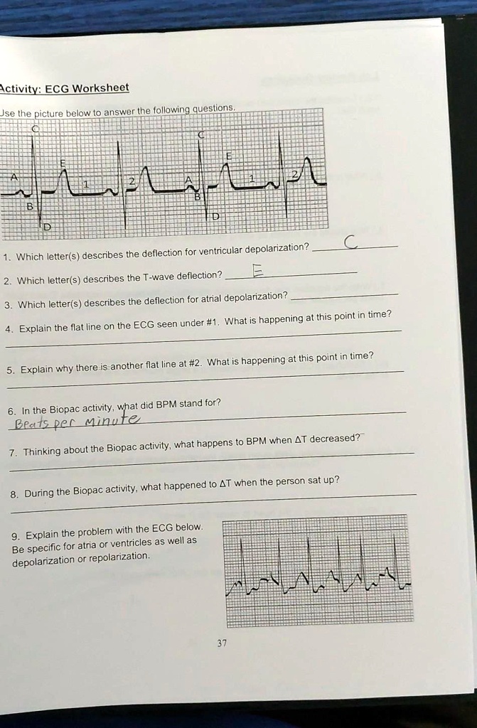 SOLVED: Activity: ECG Worksheet Use the picture below to answer the ... SOLVED: Activity: ECG Worksheet Use the picture below to answer the ...