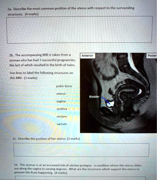VIDEO solution: 2a. Describe the most common position of the uterus ...