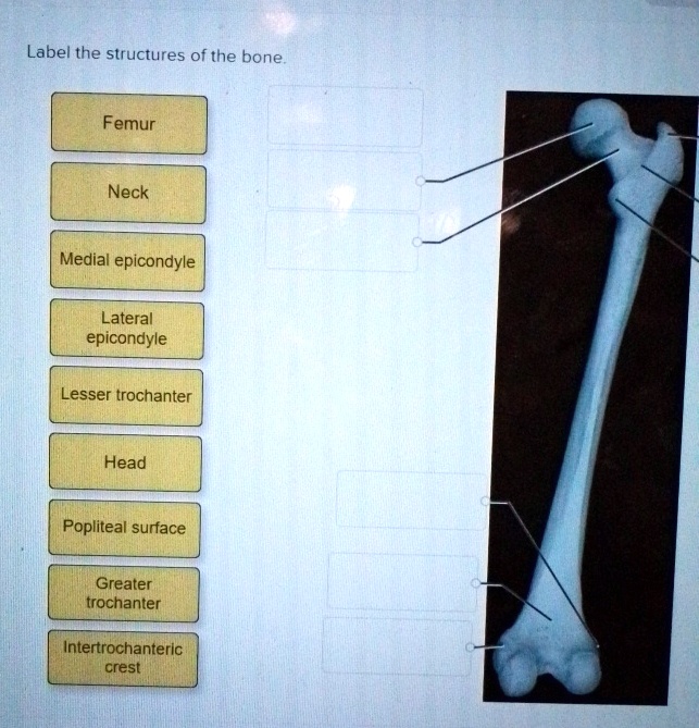 Label the structures of the bone. Femur Neck Medial epicondyle Lateral ...