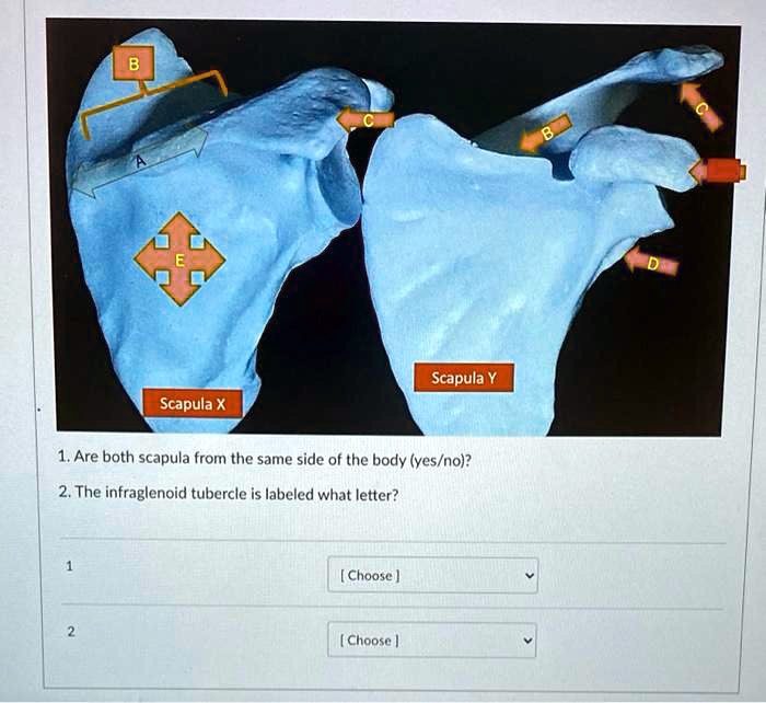 SOLVED: Scapula Y Scapula X 1. Are both scapulae from the same side of the body? (yes/no) 2. The ...