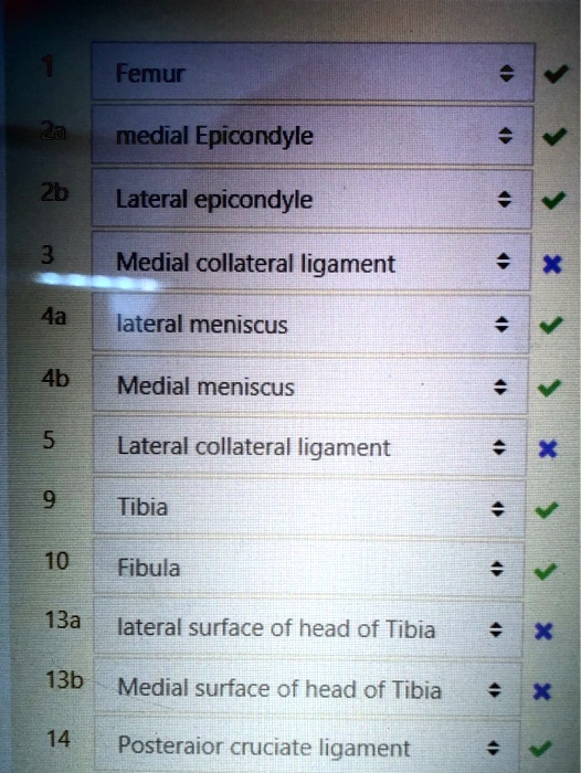 SOLVED: Femur 20 Medial Epicondyle 2b Lateral Epicondyle Medial ...
