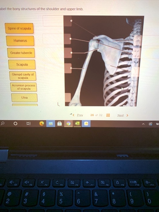 abel the bony structures of the shoulder and upper limb. Spine of scapula Humerus Greater ...