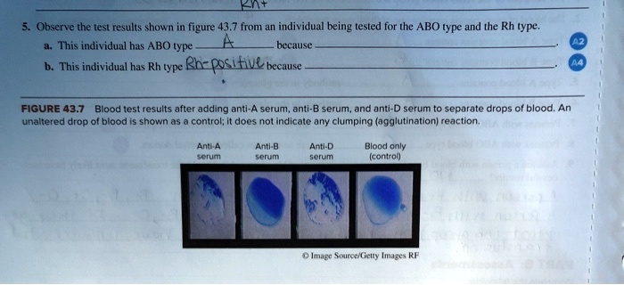 5. Observe the test results shown in figure 43.7 from an individual ...