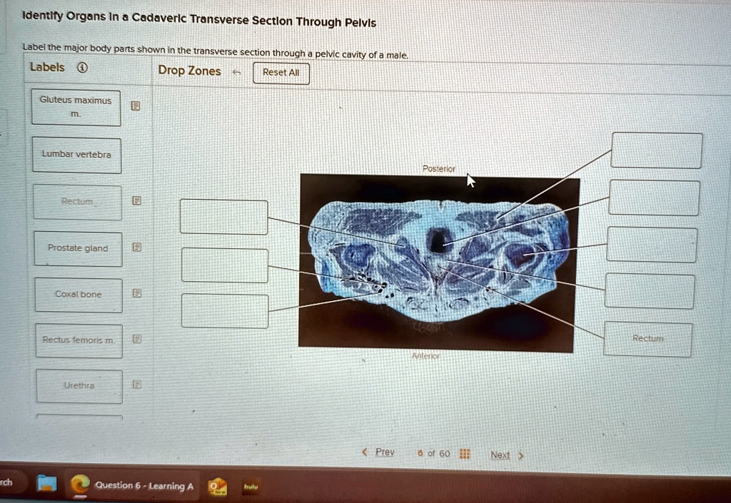 Identify Organs in a Cadaveric Transverse Section Through Pelvis Label ...