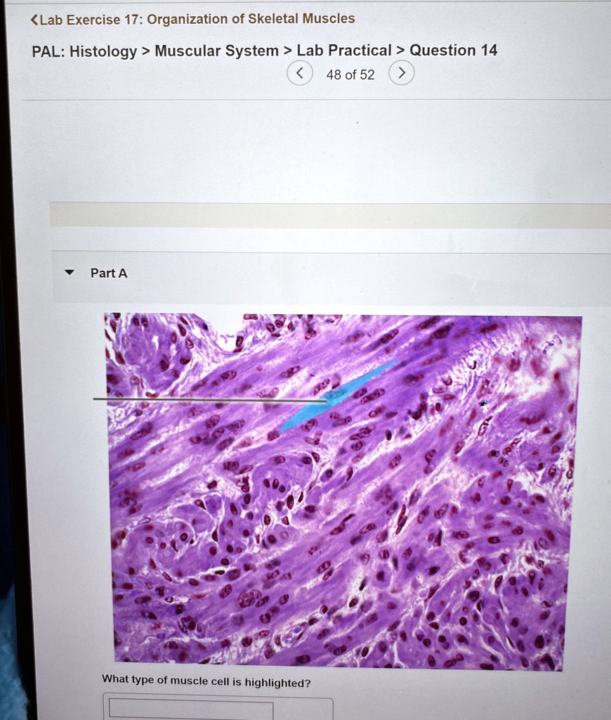 Muscular System > Lab Practical > Question 14 Part A What type of ...