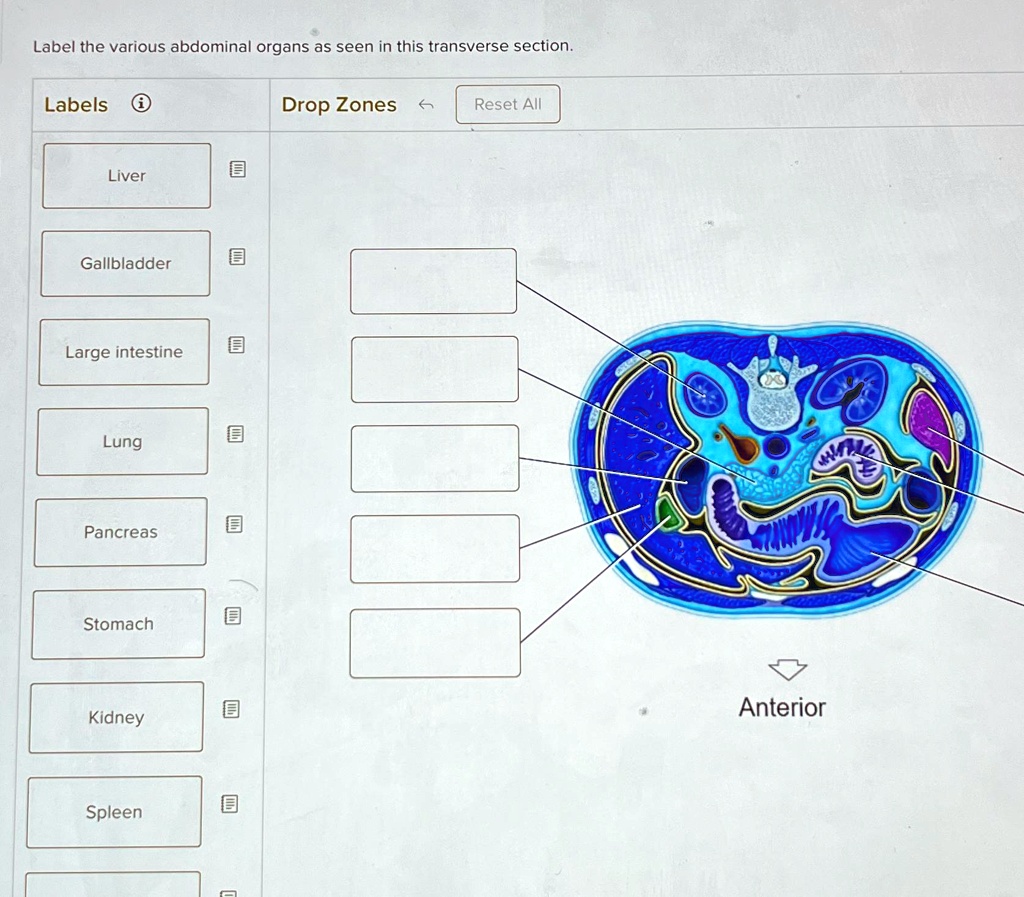 Label the various abdominal organs as seen in this transverse section ...