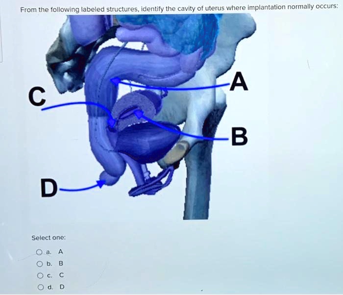 From the following labeled structures, identify the cavity of uterus ...