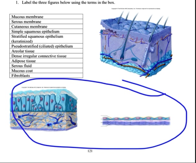 [GET ANSWER] 1 label the three figures below using the terms in the box mucous membrane serous ...