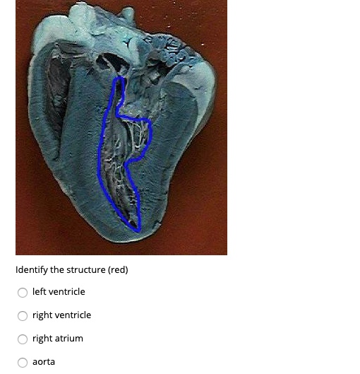 SOLVED: Identify the structure (red) O left ventricle O right ventricle O right atrium O aorta