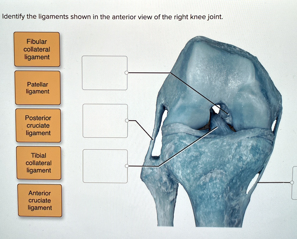 Identify the ligaments shown in the anterior view of the right knee ...