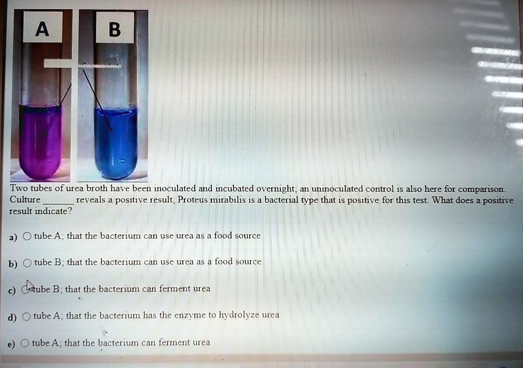 SOLVED: A B Two tubes of urea broth have been inoculated and incubated ...