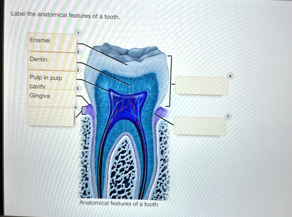 Label the anatomical features of a tooth. Enamel Dentin Pulp in pulp ...