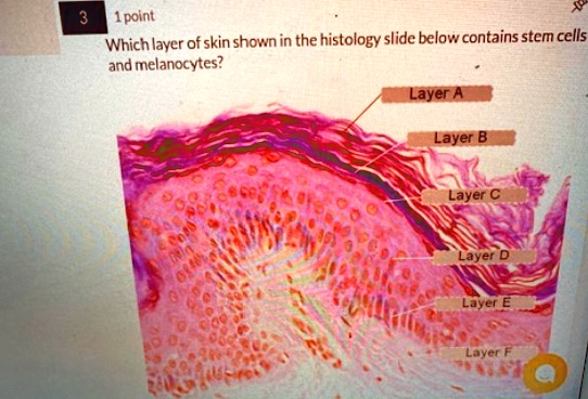Which layer of skin shown in the histology slide below contains stem ...