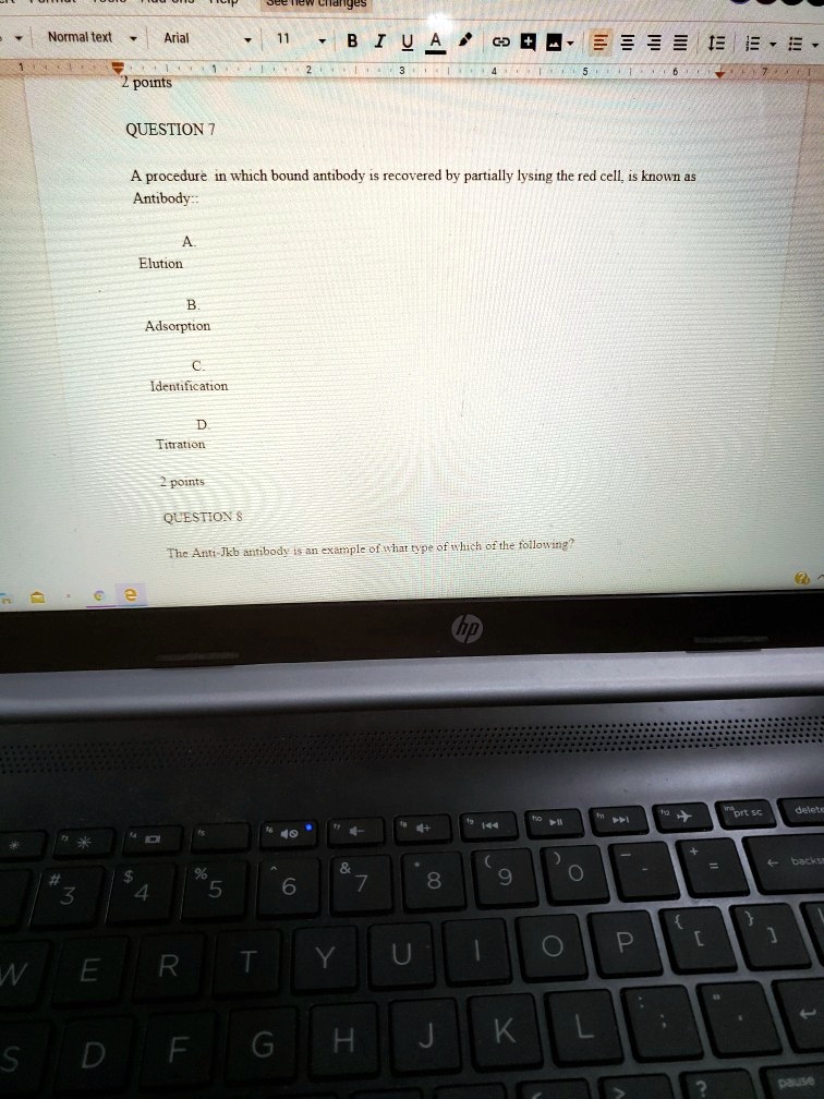 Normal text Arial 11 BIUA 2 points QUESTION 7 A procedure in which ...