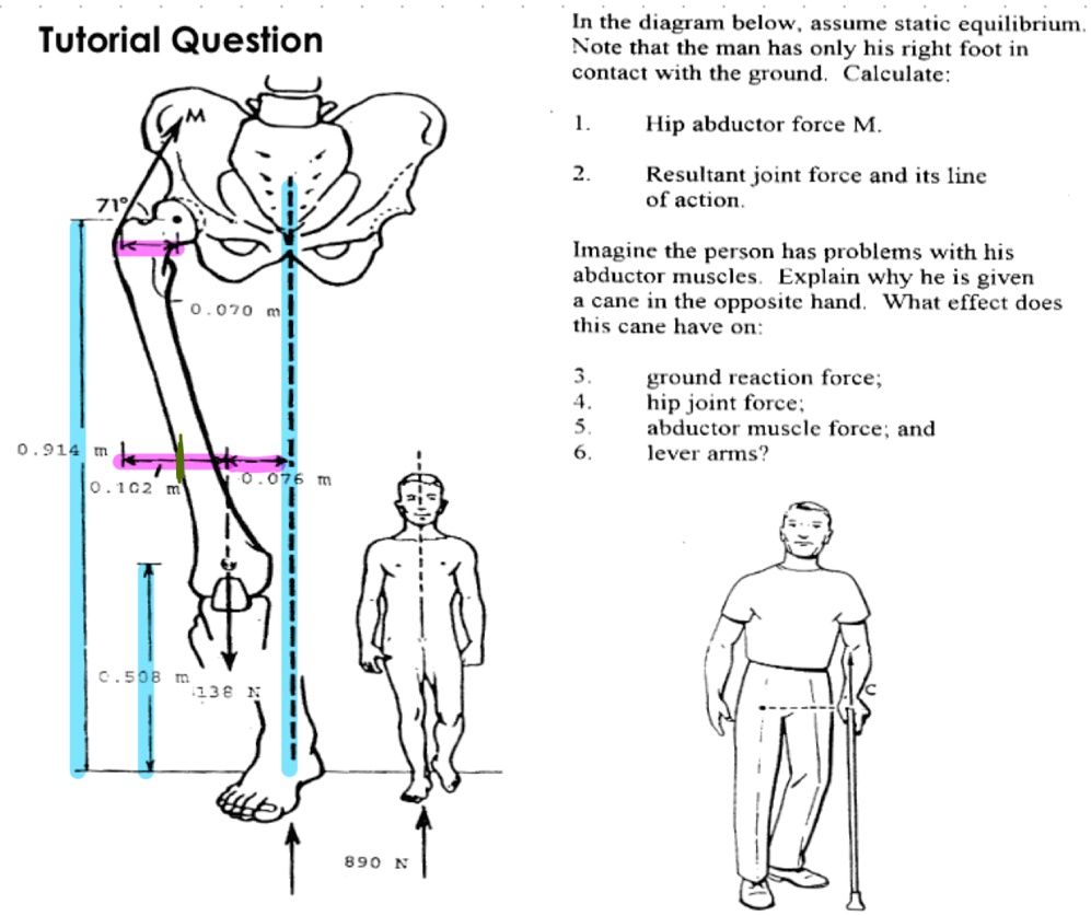 Tutorial Question 71° M In the diagram below, assume static equilibrium ...