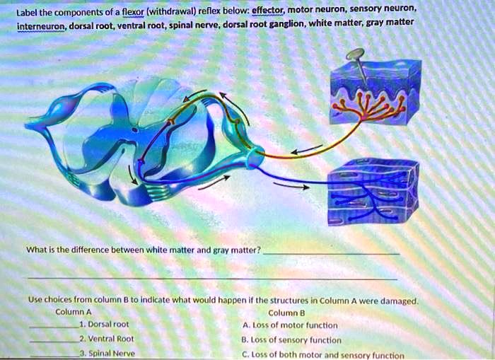 Label the components of a flexor (withdrawal) reflex below: effector, motor neuron, sensory ...