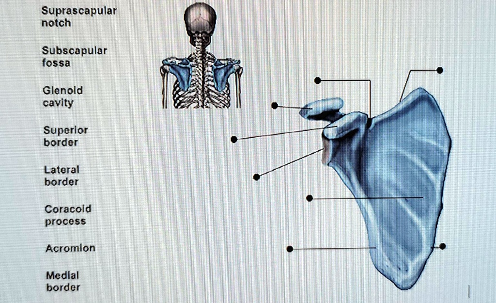 SOLVED: Correctly label the diagram: Suprascapular notch Subscapular ...