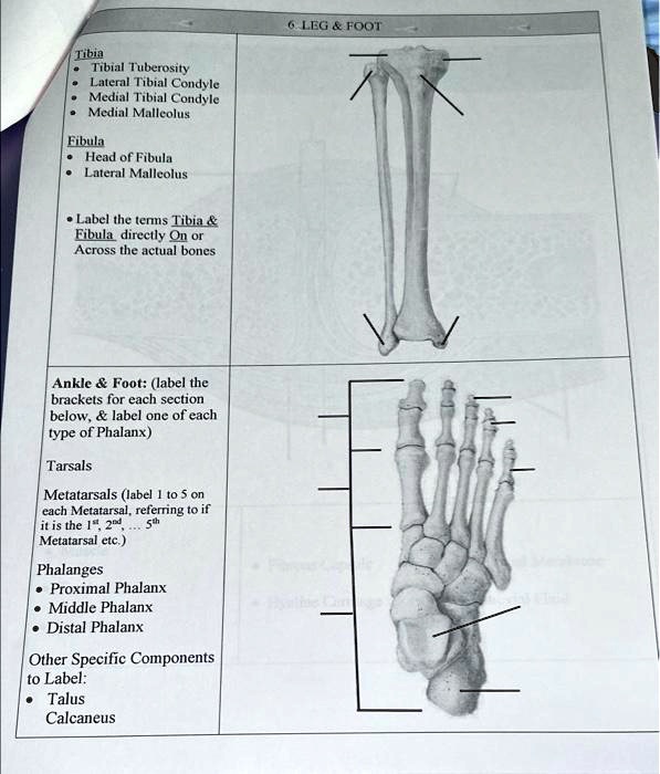 Tibia Tibial Tuberosity Lateral Tibial Condyle Medial Tibial Condyle ...