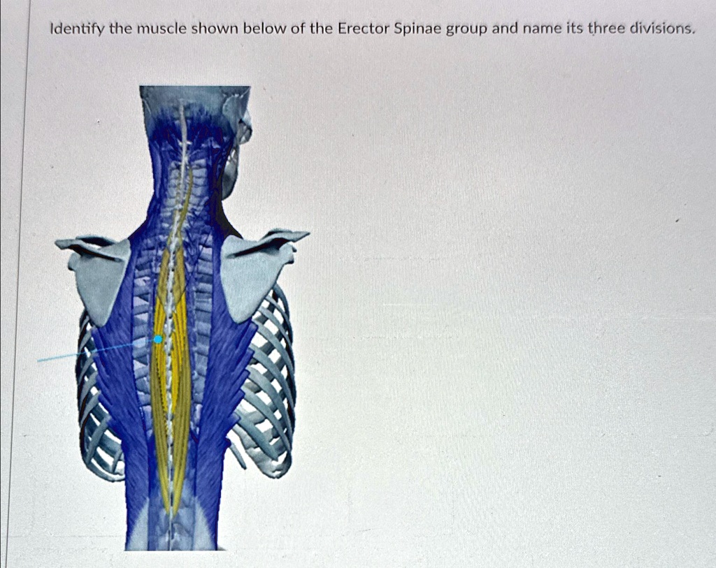 SOLVED: Identify the muscle shown below of the Erector Spinae group and ... SOLVED: Identify the muscle shown below of the Erector Spinae group and ...