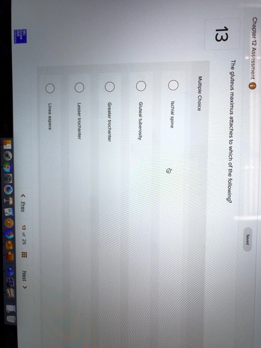 SOLVED: Chapter 12 Assessment Linea aspera Ischial spine Multiple ...
