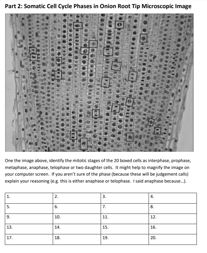 Part 2: Somatic Cell Cycle Phases in Onion Root Tip Microscopic Image ...