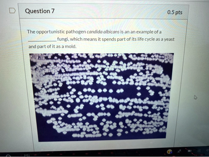 SOLVED: Question 7 0.5 pts The opportunistic pathogen candida albicans ...