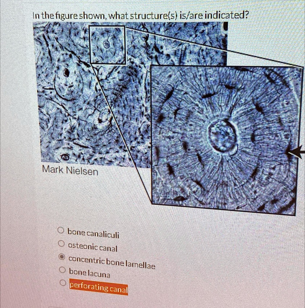 in the figure shown what structures isare indicated bone canaliculi ...