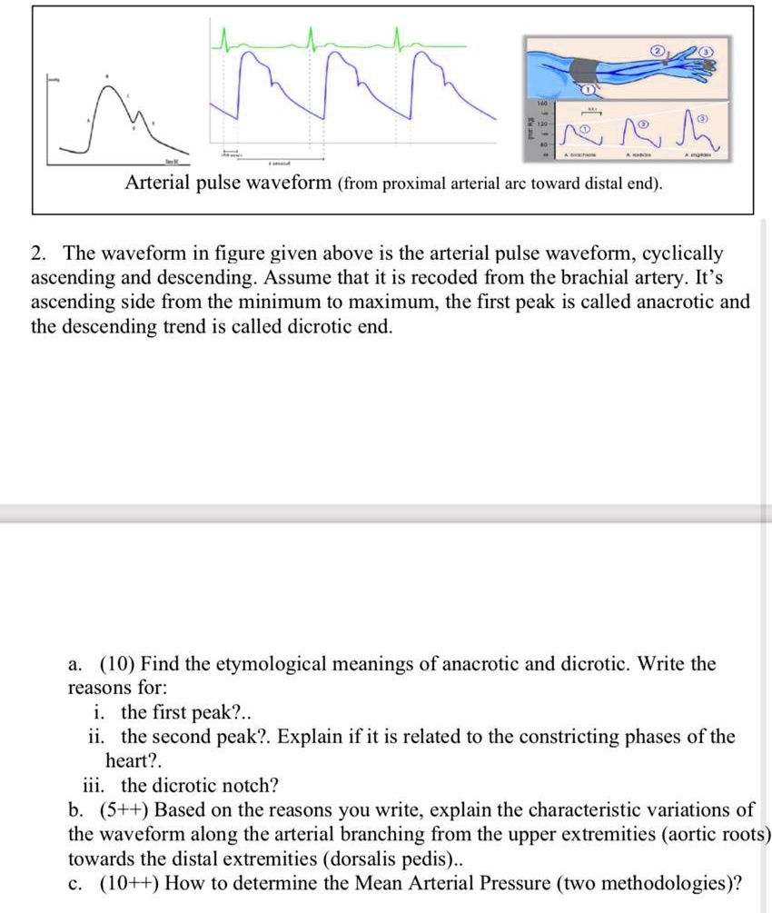 Arterial pulse waveform (from proximal arterial arc toward distal end ...