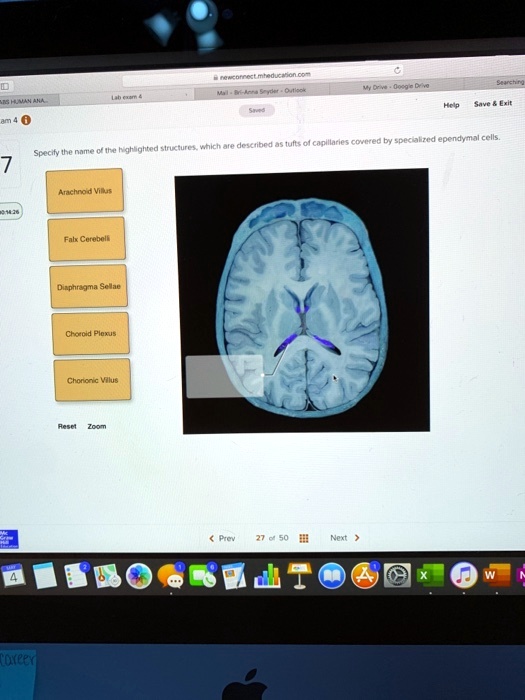 Specify the name of the highlighted structures, which are described as tufts of capillaries ...