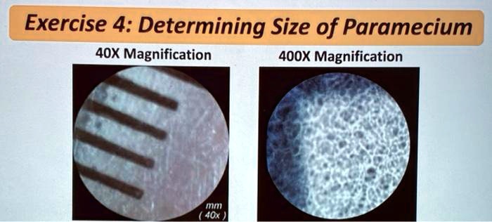 SOLVED: Exercise 4: Determining Size of Paramecium 4OX Magnification ...