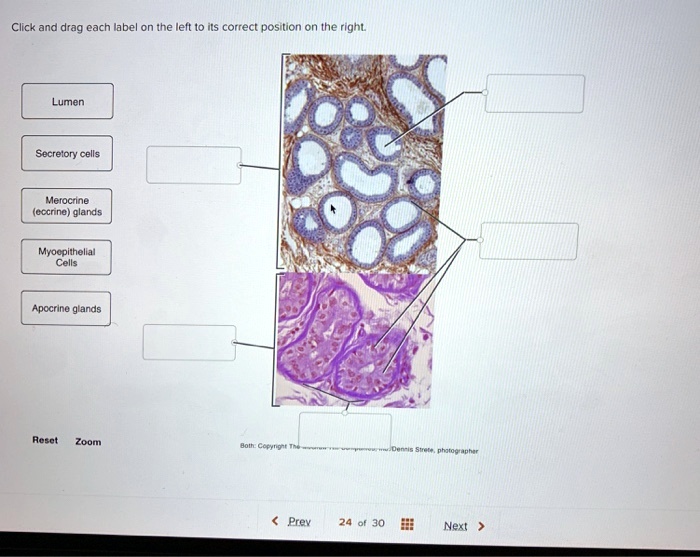 Click and drag each label on the left to its correct position on the right. Lumen Secretory ...