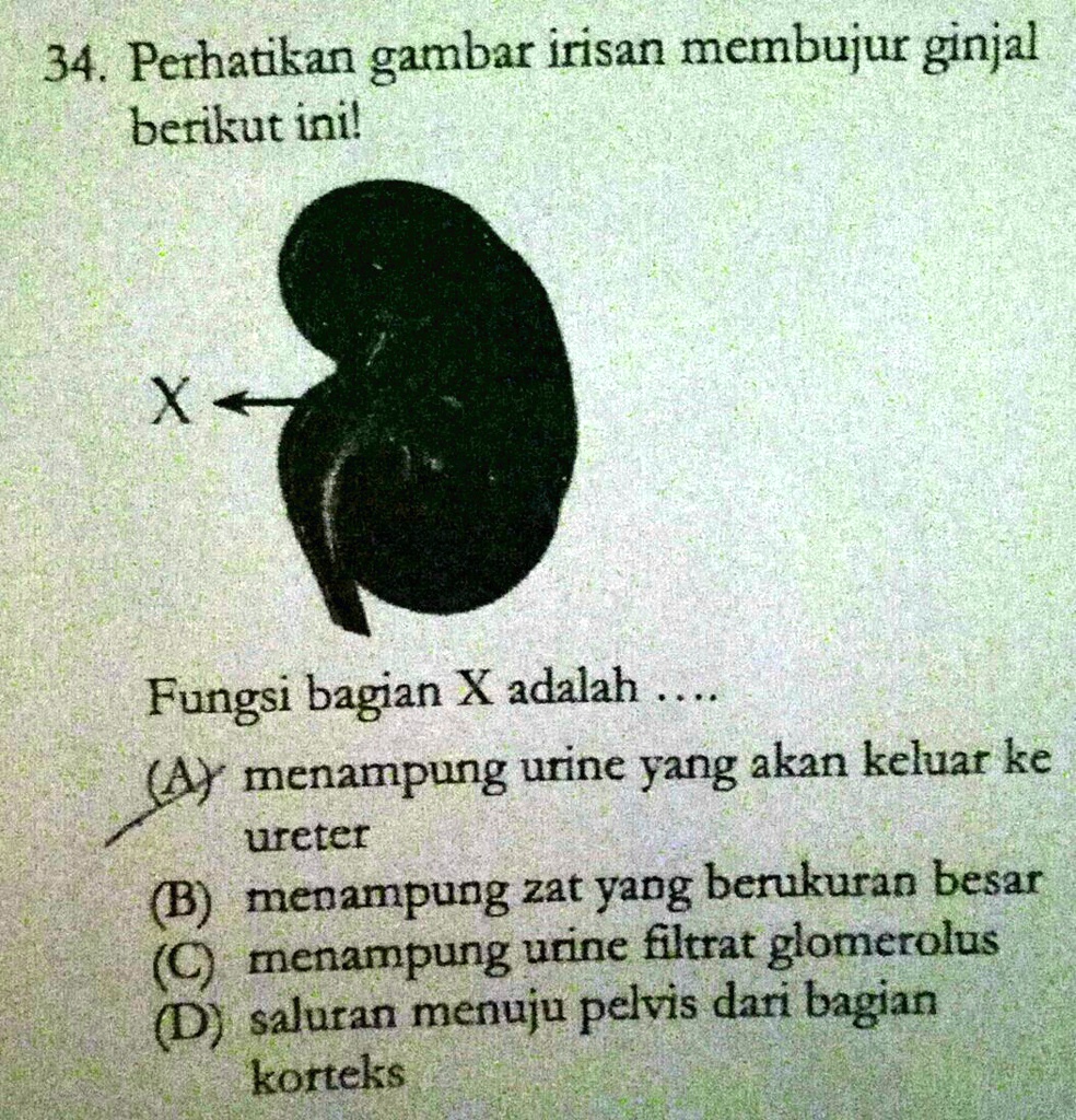 SOLVED: Perhatikan gambar irisan membujur ginjal berikut ini! fungsi ... SOLVED: Perhatikan gambar irisan membujur ginjal berikut ini! fungsi ...